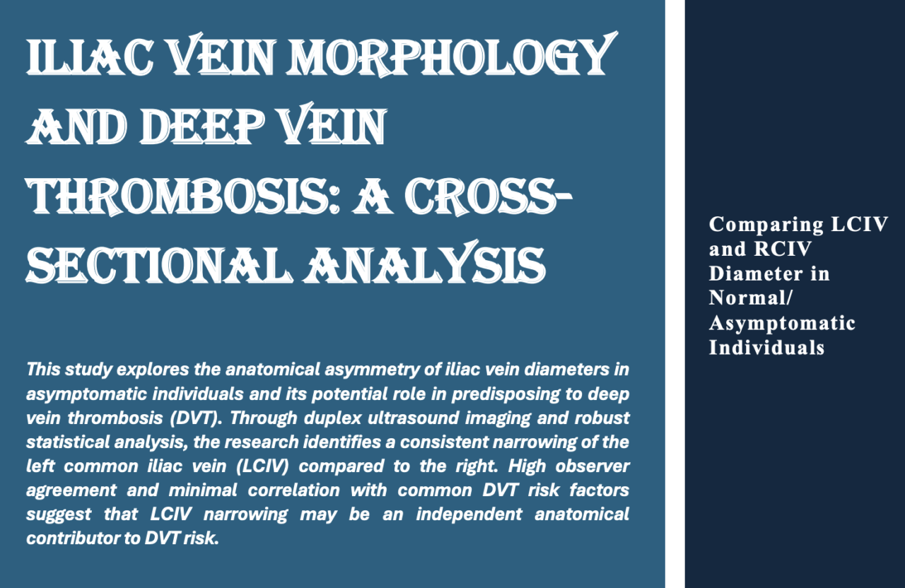 Why is DVT More Common In the Left Leg? Dr Raheel Moazzam's New Study ...